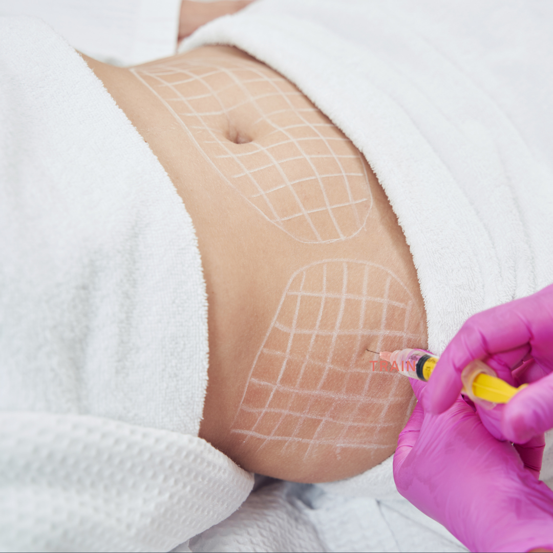 Injections for Body Fat Reduction-Effective? - Healthhype