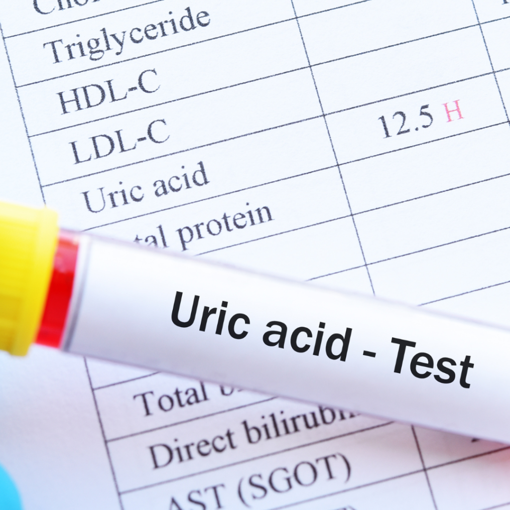 High Uric Acid Levels: Causes and Solutions - Healthhype