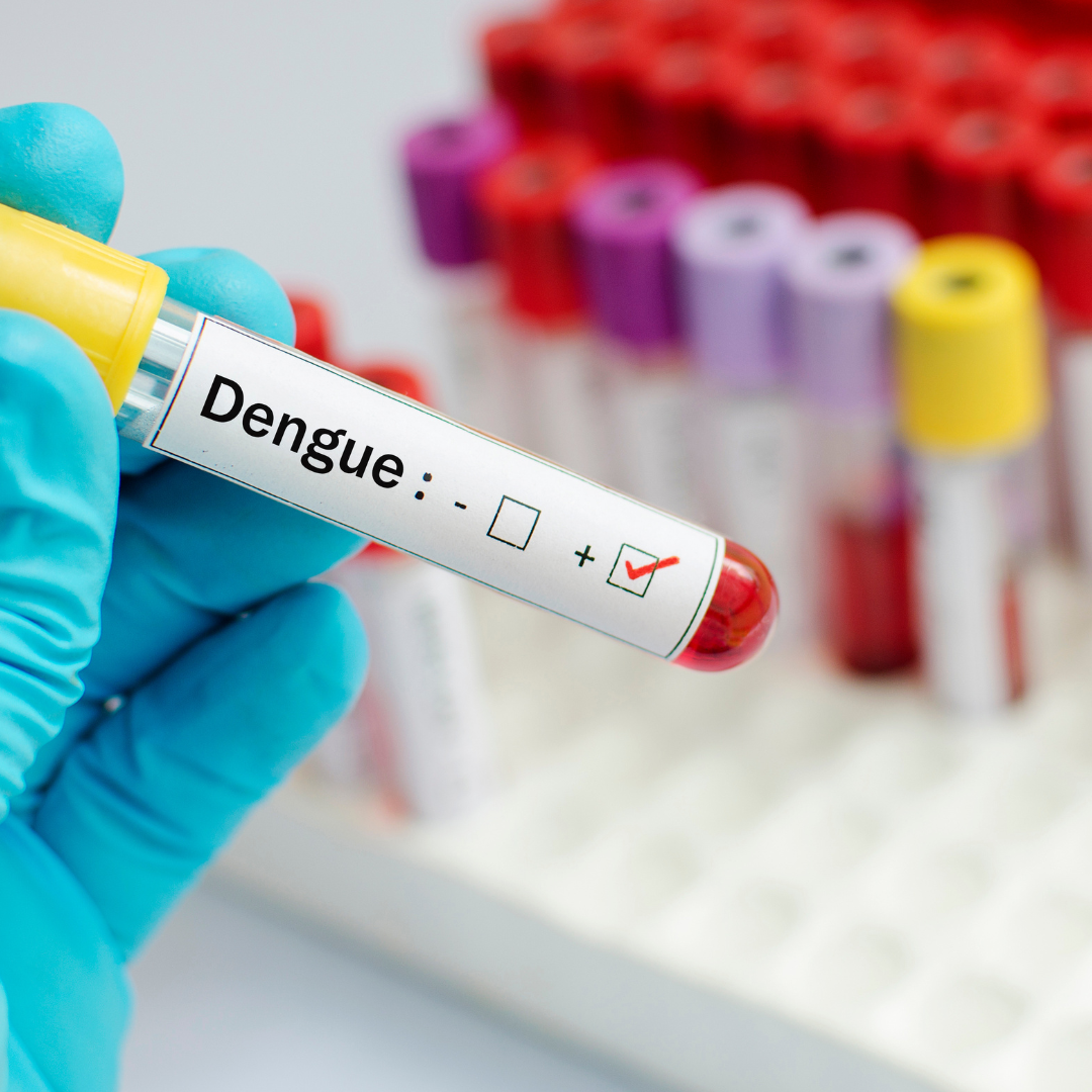 Dengue Fever: Symptoms, Causes & Prevention - Healthhype