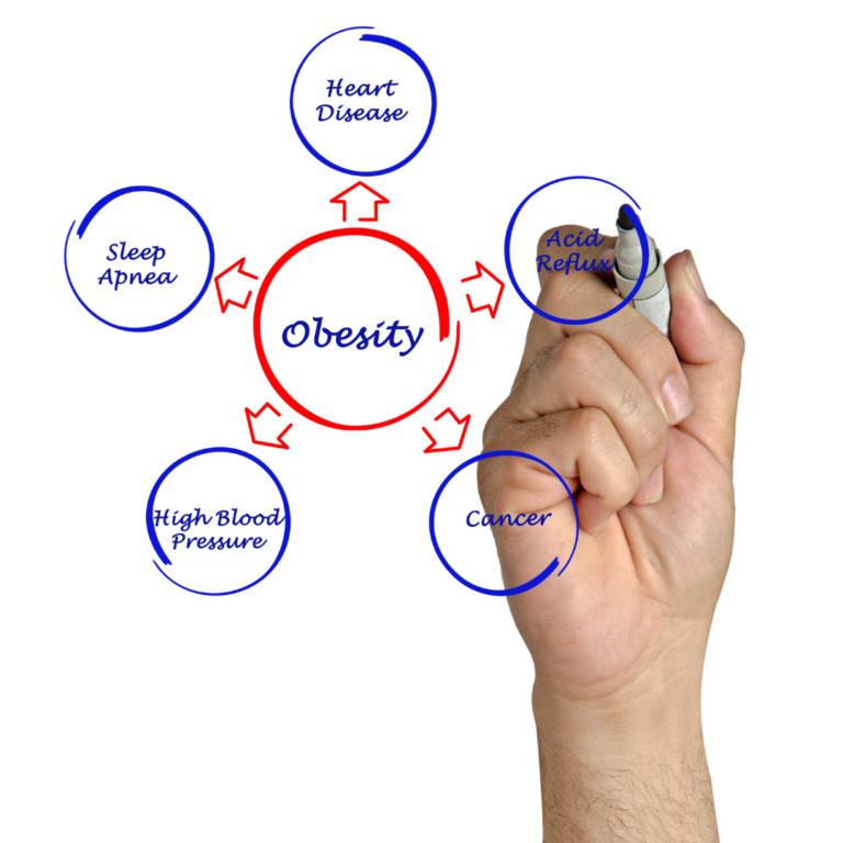 Obesity in Adults: Key Causes and Solutions - Healthhype