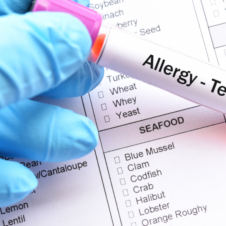 Age Food Allergy Reactions: Essential Management Tips - Healthhype