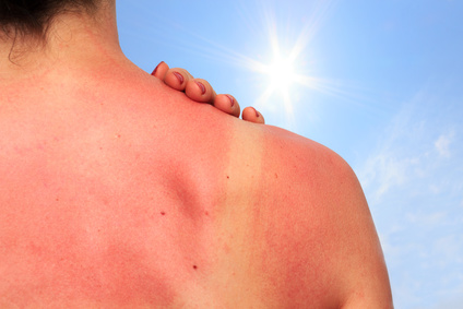 Burning Skin Sensation (Feeling) Causes With or Without Rash - Healthhype
