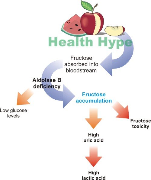 Fructose Enzyme Deficiency Causes, Symptoms and Treatment - Healthhype