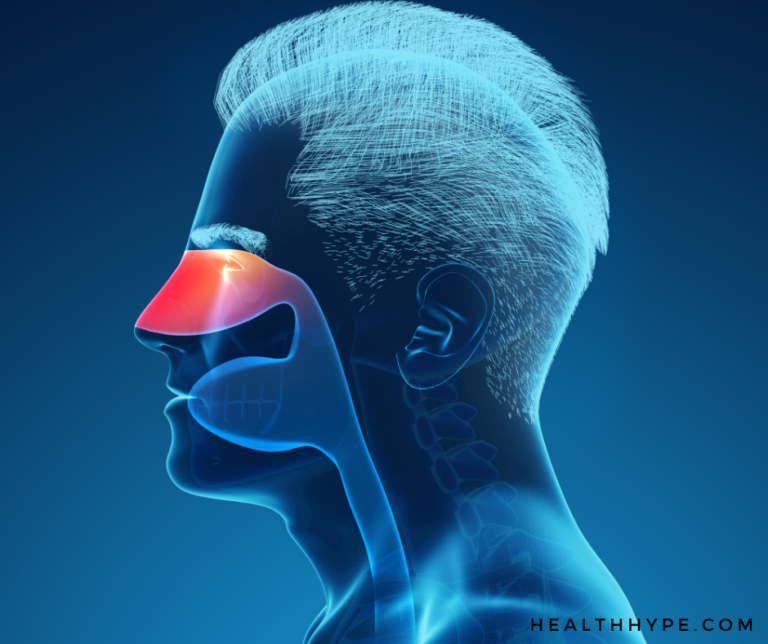Sinusitis vs Common Cold: Understanding the Symptoms - Healthhype